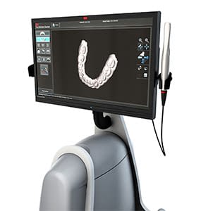 3M True Definition Scanner - Kennewick Dental